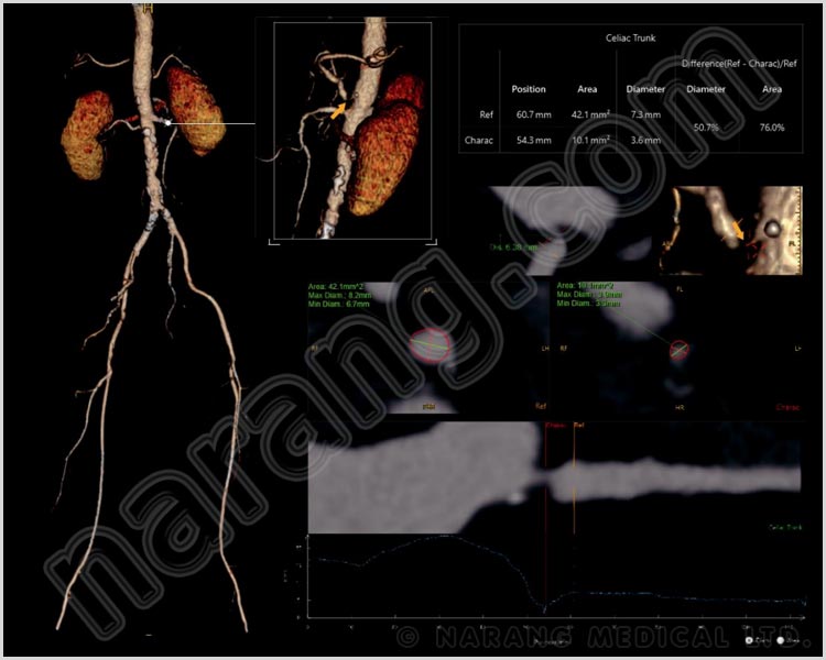 CT Scan 32 Slices | CT Scan 32 Slices Suppliers | CT Scan 32 Slices ...